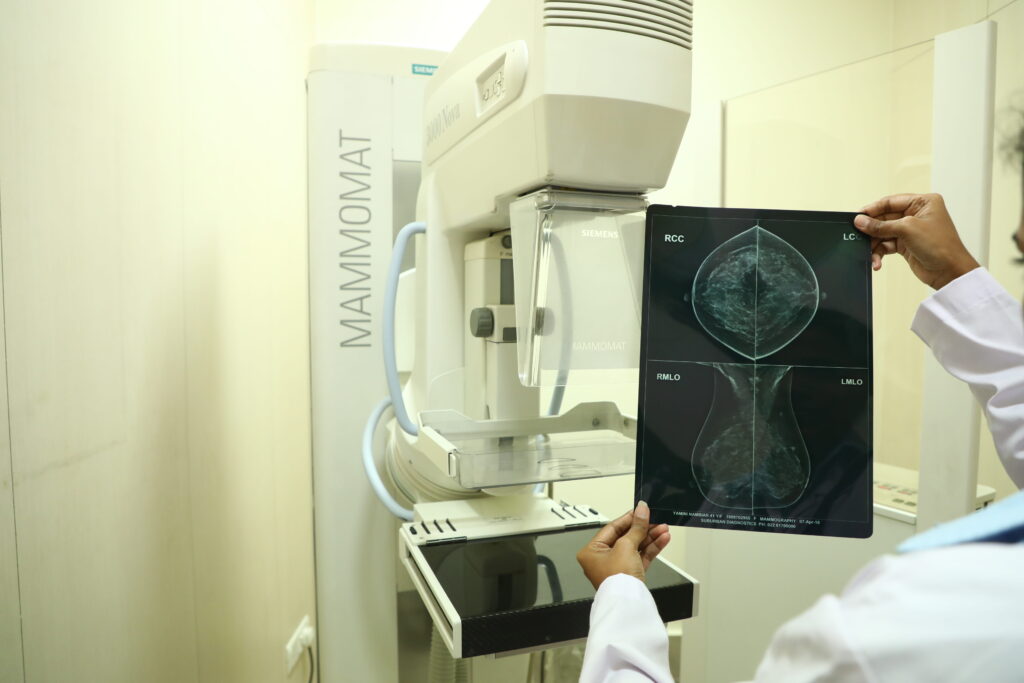 Understanding Why Mammograms Matter | Suburban Diagnostics