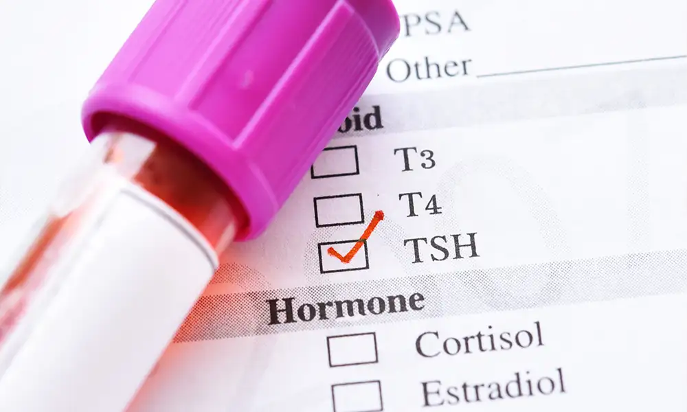 Interpretation of Thyroid Function Test | Suburban Diagnostics